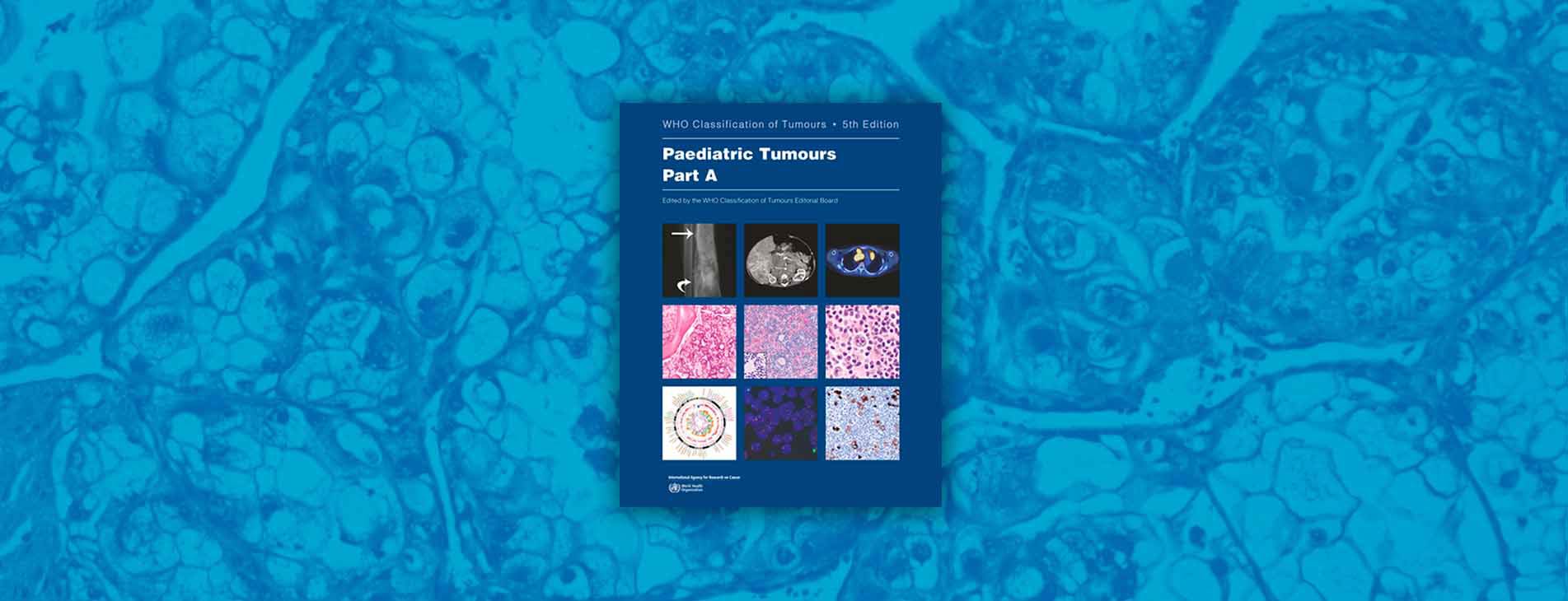 IARC – INTERNATIONAL AGENCY FOR RESEARCH ON CANCER