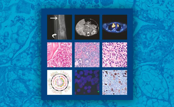 IARC – INTERNATIONAL AGENCY FOR RESEARCH ON CANCER